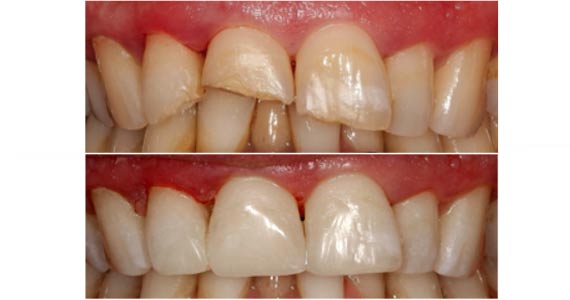 Birchington Dental Care Gallery