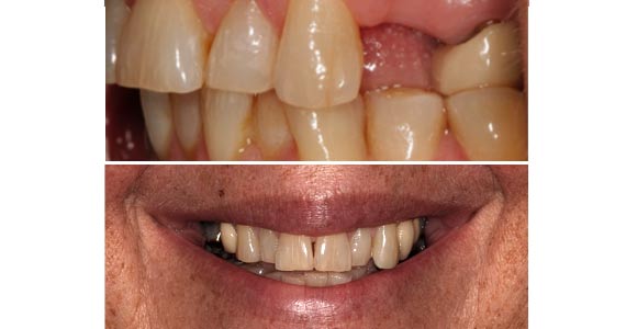 Birchington Dental Care Gallery